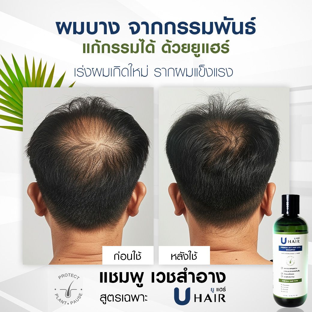 U hair premium anti hair loss shampoo (200ml.) 1 ขวด